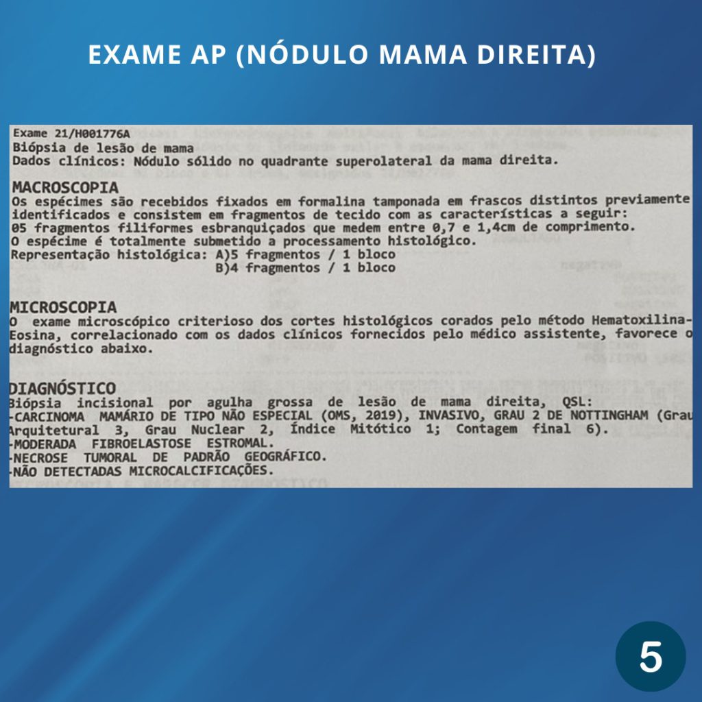 Caso do Dia – Paciente com nódulo na axila direita | Sociedade de ...